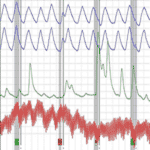 Lie Detector Tests - Polygraph Exams | Global Polygraph Network®