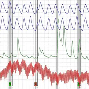 Lie Detector Tests - Polygraph Exams | Global Polygraph Network®